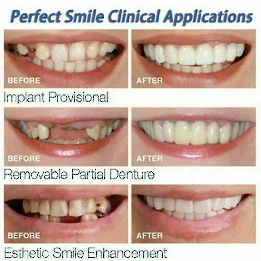 New 4 Pcs Snap On Smile Teeth Veneers Whitening Cosmetic Denture, Toot ...
